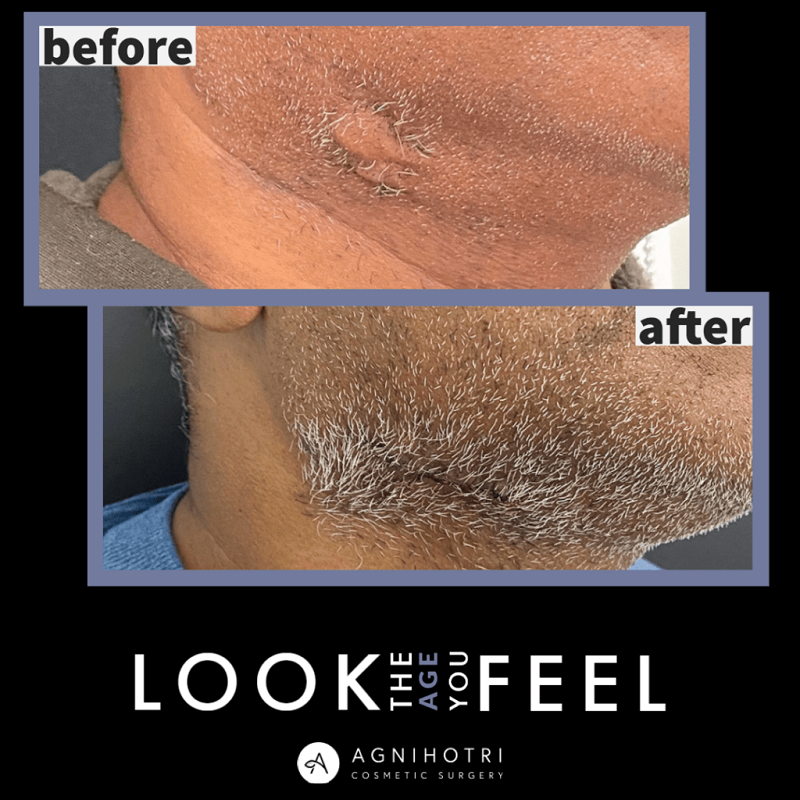 Cosmetic Surgery Specialist Henrico VA | Cosmetic Surgery