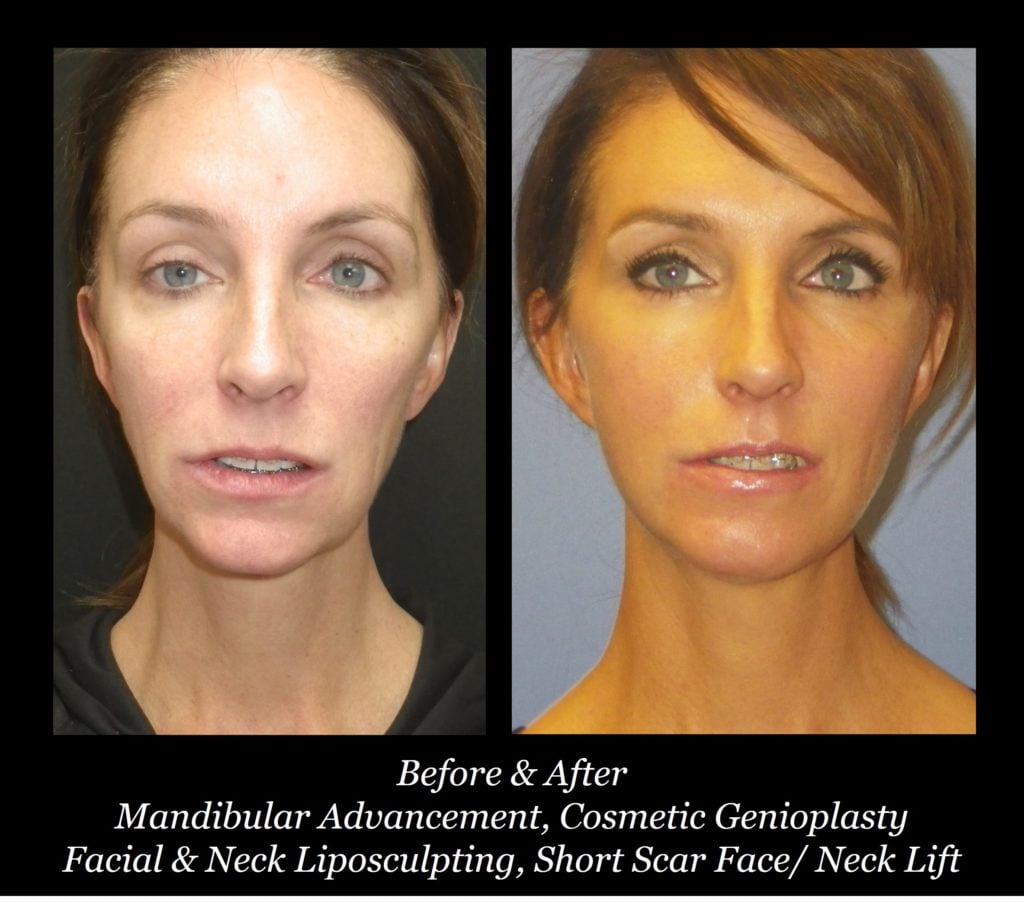 Cosmetic Surgery Specialist Henrico VA | Cosmetic Surgery
