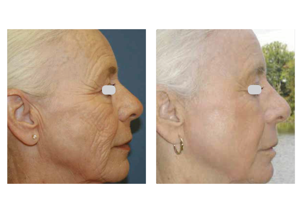 Cosmetic Surgery Specialist Henrico VA | Cosmetic Surgery